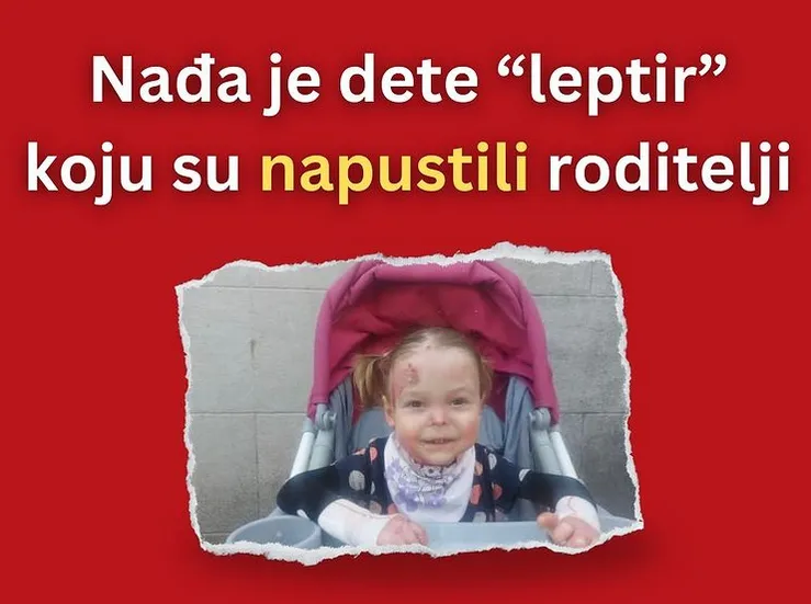 Humanitarna akcija za Nađu – dete „leptira“ koje su napustili roditelji ...