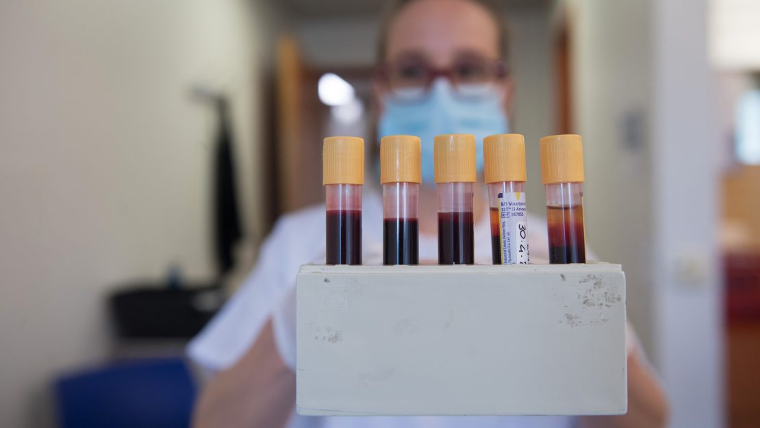 SAD: Test otkriva virus za 24 sata