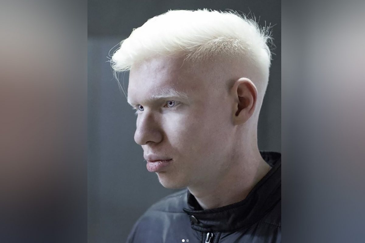 Albino za Nova.rs: "Ne bih se menjao ni za čiji ten"
