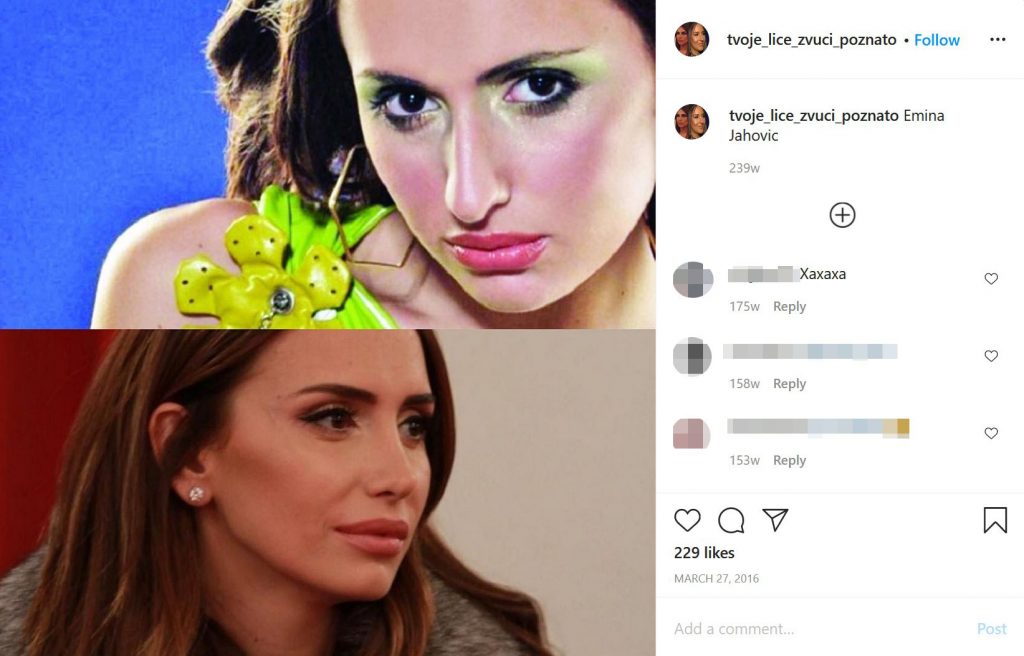 FOTO Kako je Emina Jahović izgledala pre svih operacija