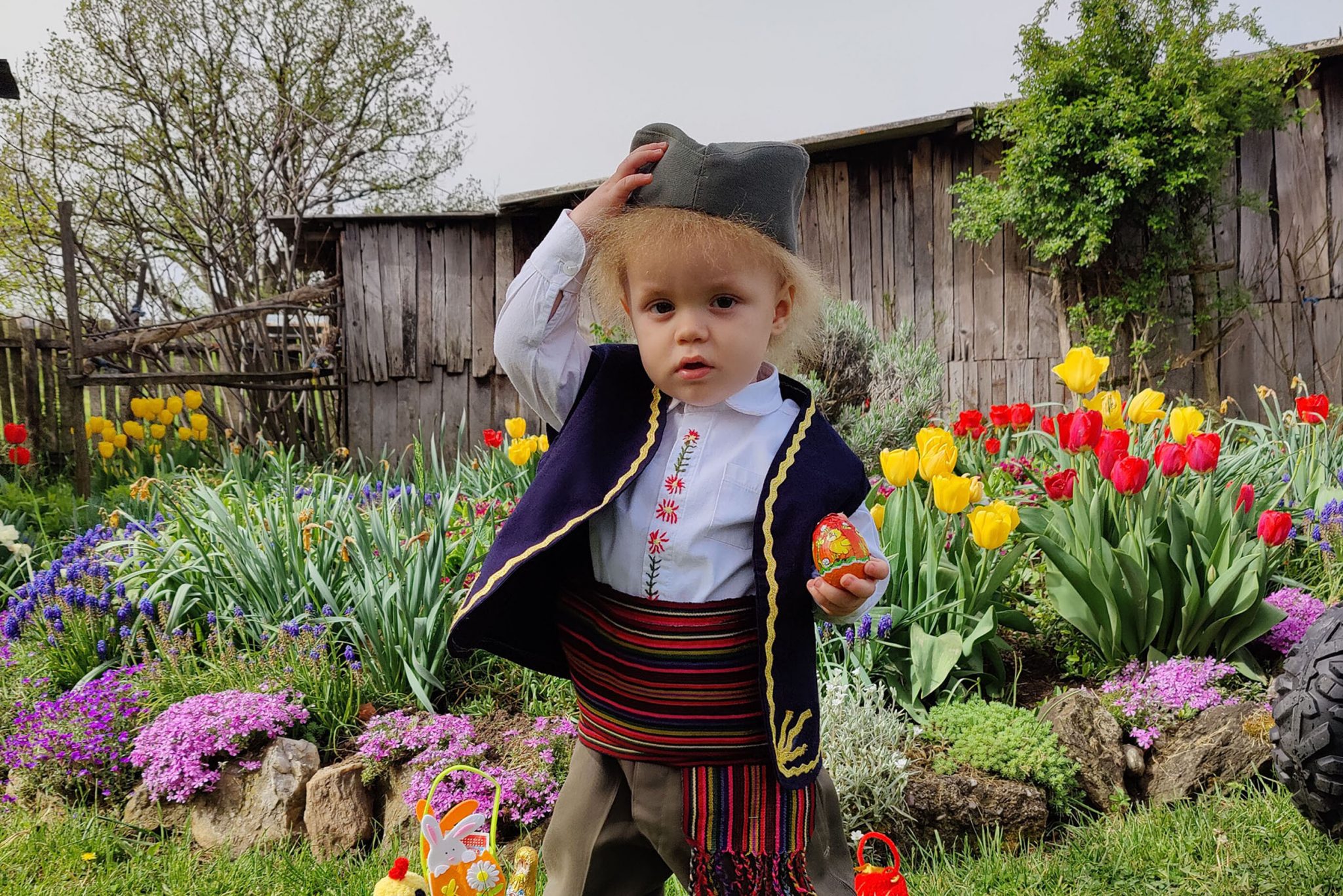 Samo 100 dece na svetu ima ovakvu kosu - mali Lav iz Kragujevca je među ...