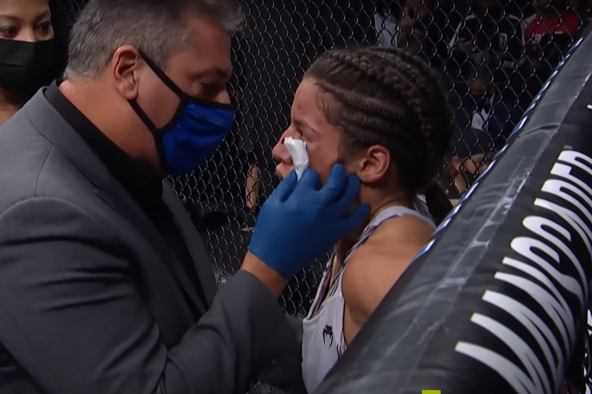 VIDEO MMA borkinja izgubila deo čela u krvavoj borbi i završila u bonici