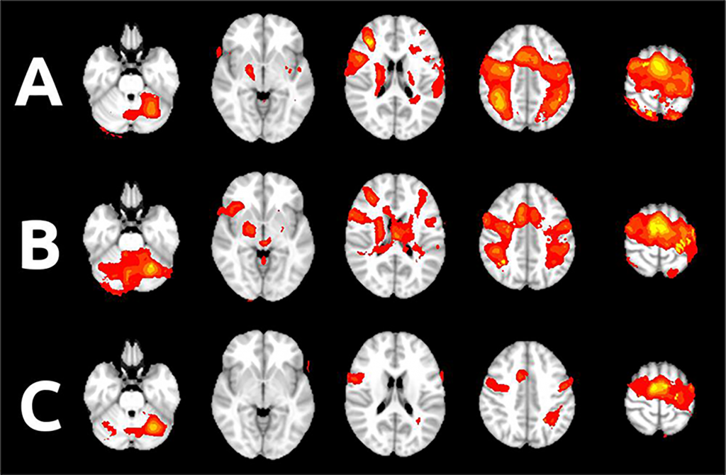 FOTO Radiolog Ivković otkrio kako botoks zapravo utiče na mozak