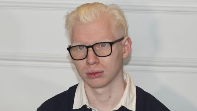 Stjepan Jelica Albino Archives - NOVA portal