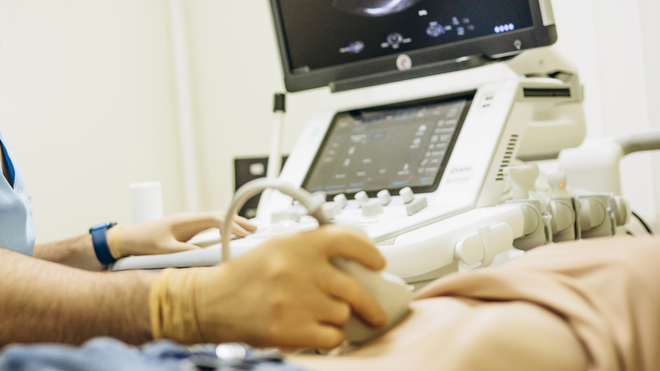 Šta su miomi, kako nastaju i koji su njihovi osnovni tipovi?