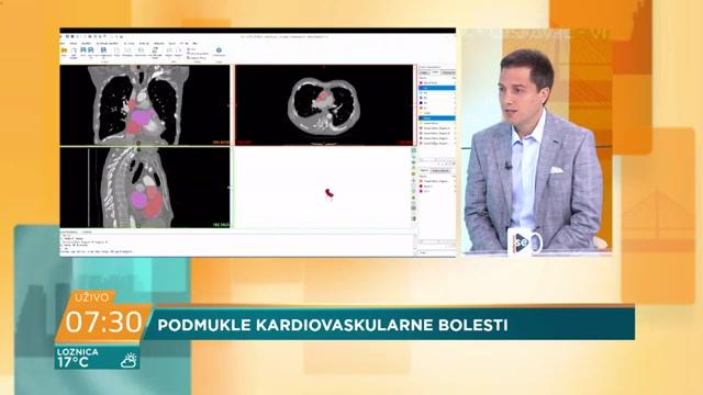 Doc. dr Marko Banović: Podmukle kardiovaskularne bolesti