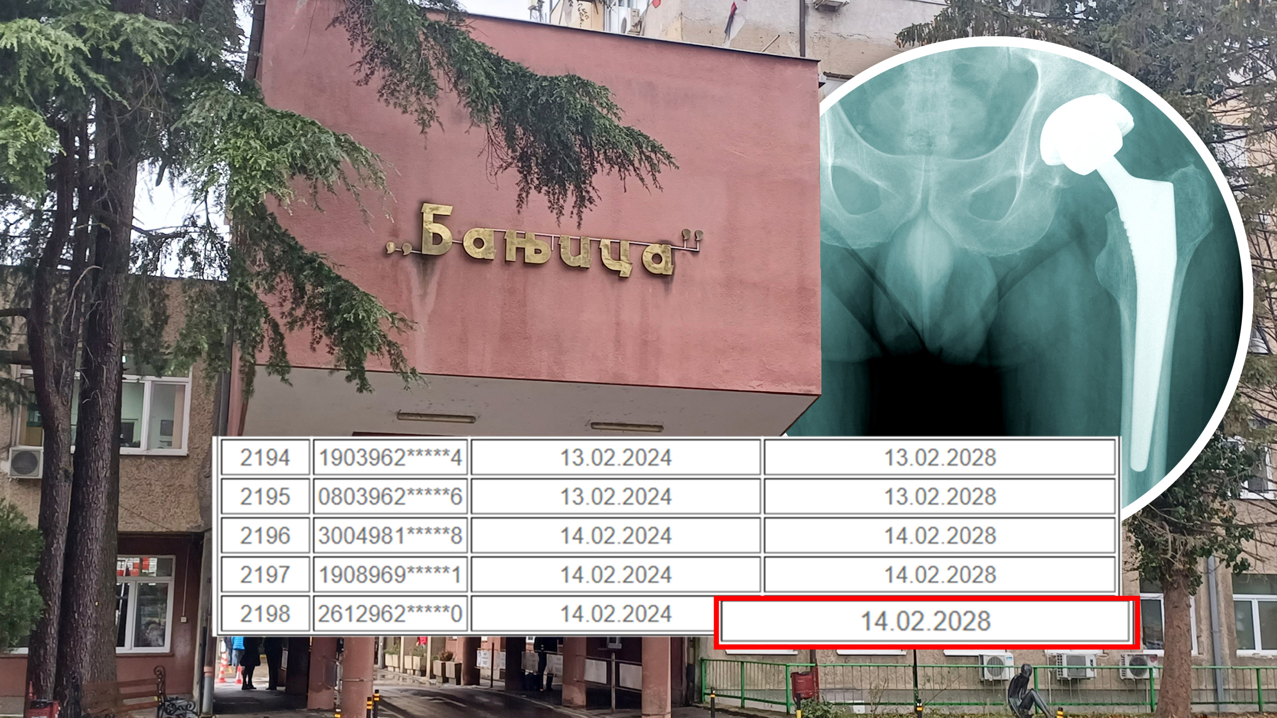 Boli vas kuk ili koleno? Spremite se da čekate operaciju bar četiri ...
