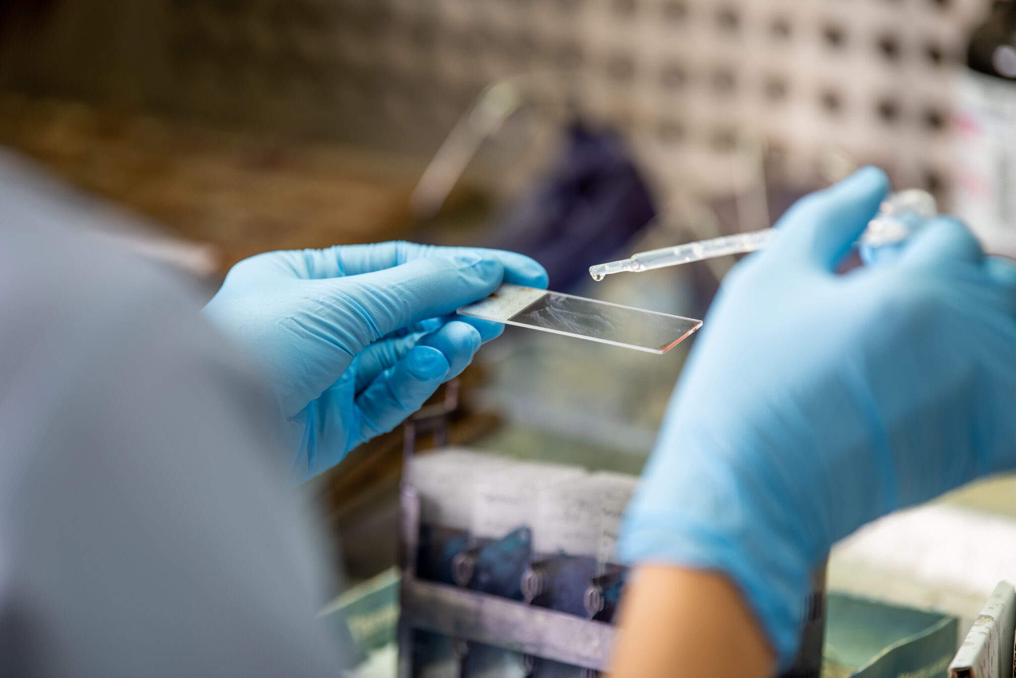 Šta znači koja grupa Papa testa