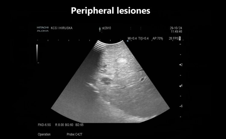 Srpski hirurzi izveli operaciju na jetri kojoj se divi svet