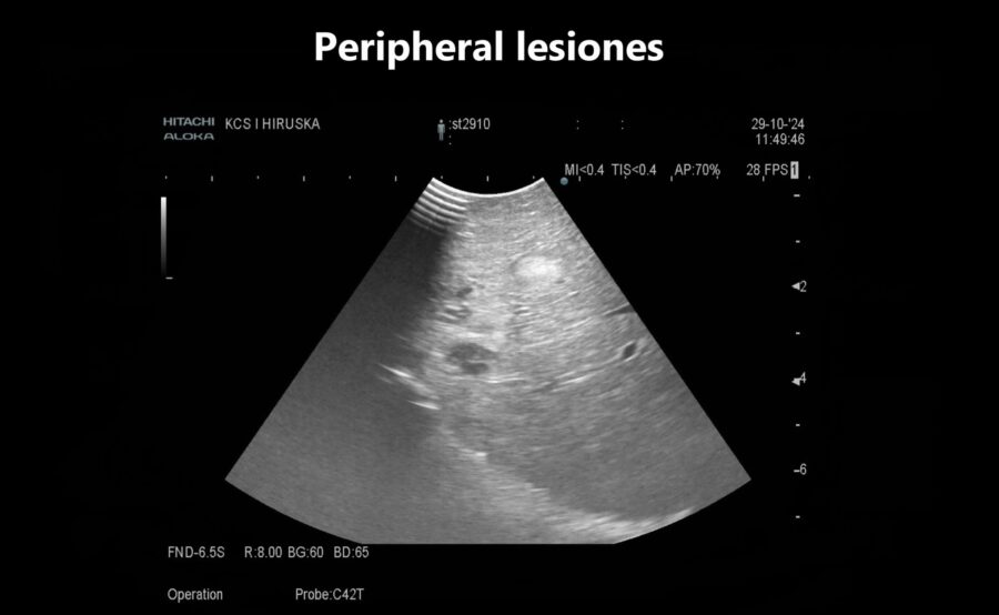Srpski hirurzi izveli operaciju na jetri kojoj se divi svet
