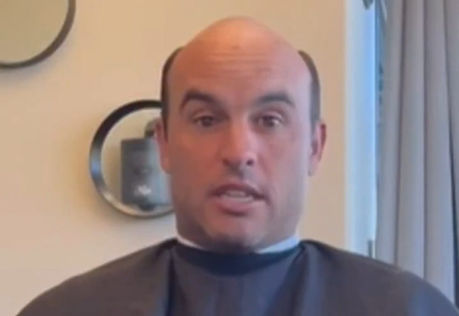 Presađivanje kose nije uspelo, Donovan našao drugo rešenje