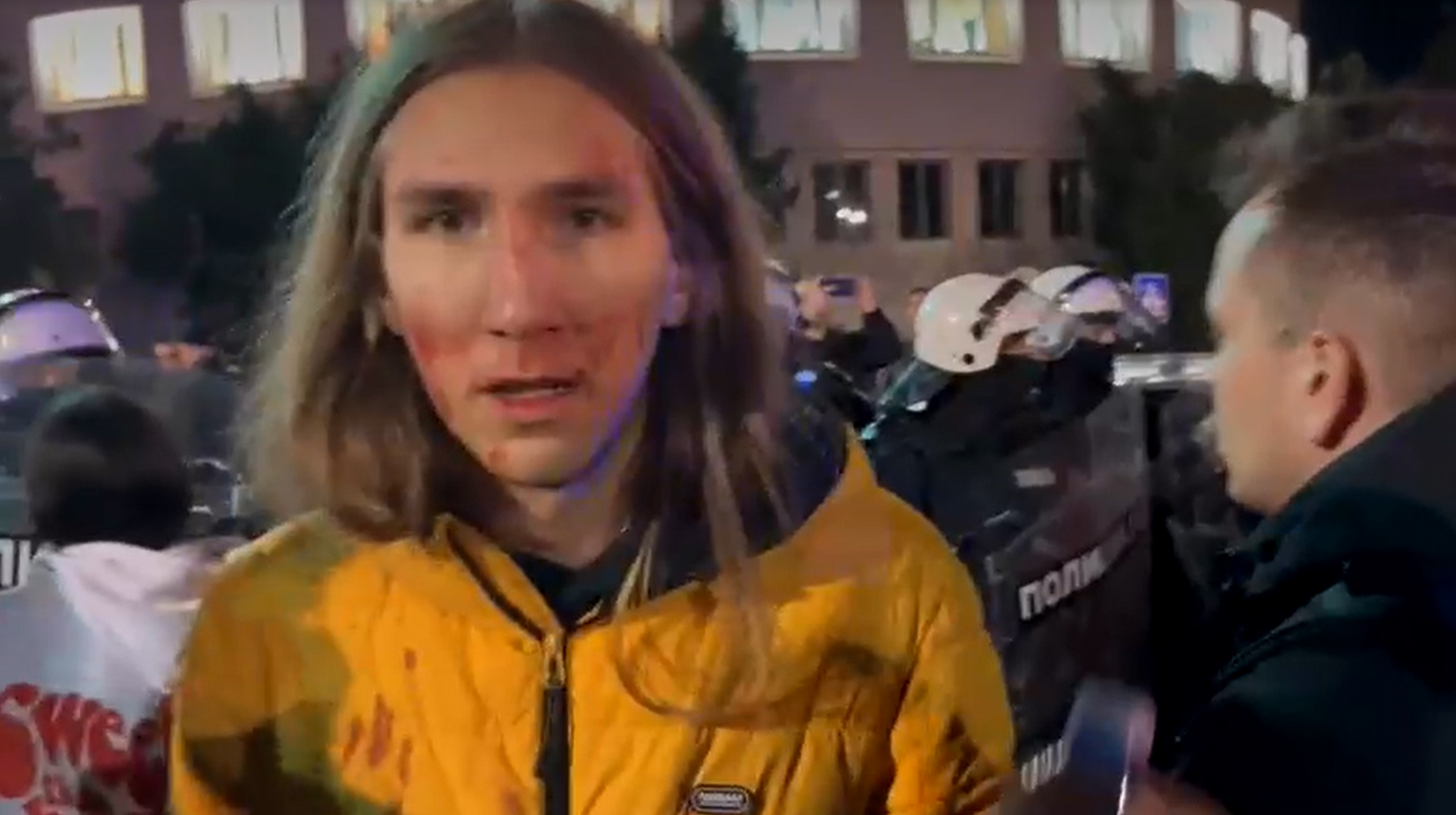 Student Vukašin o nasilju koje je pretpeo sinoć od strane žandarma