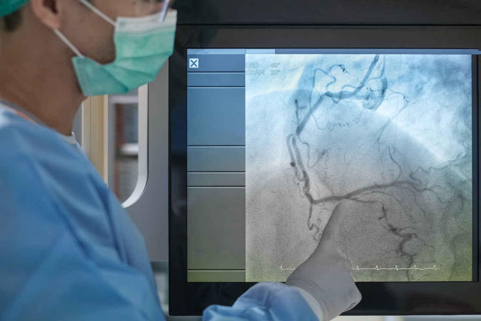 Interventna radiologija